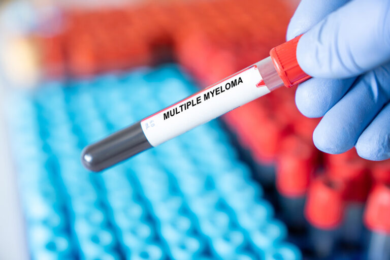 IDP-023: Safety, Efficacy in Relapsed/Refractory Myeloma - SOHO Insider